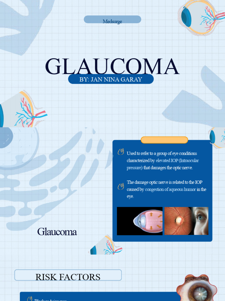 Glaucoma | PDF | Glaucoma | Medicine