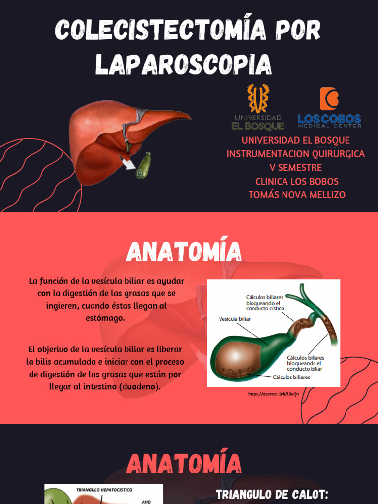 Colecistectomía Por Laparos | PDF | Sistema digestivo | Abdomen