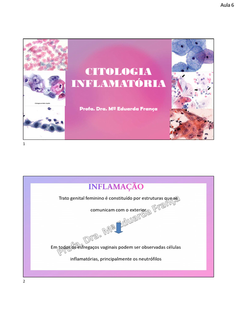 Aula_6-_Citologia_inflamat_ria_Profa_M__Eduarda_2023 | PDF | Inflamação ...