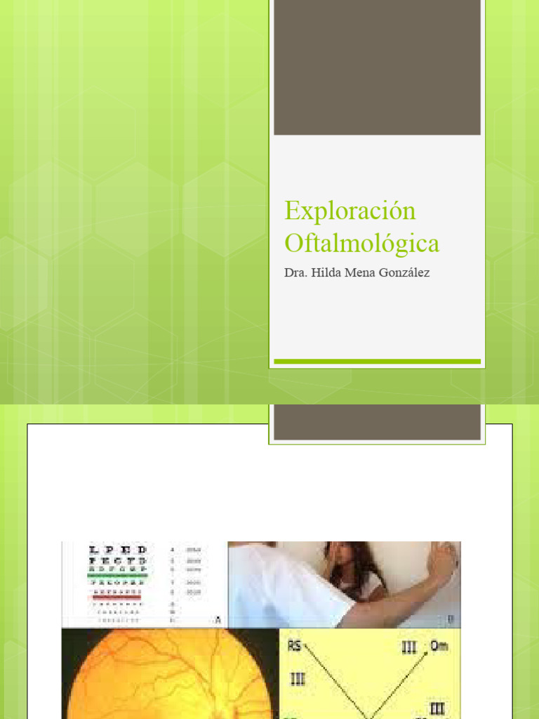 Exploracion Oftalmológica | PDF | Ojo humano | Ojo