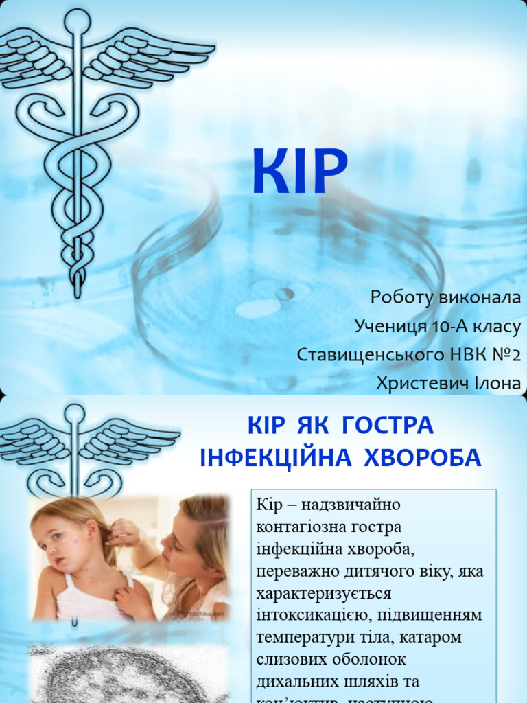 Prezentaciya Na Temu Kir Skachaty | PDF