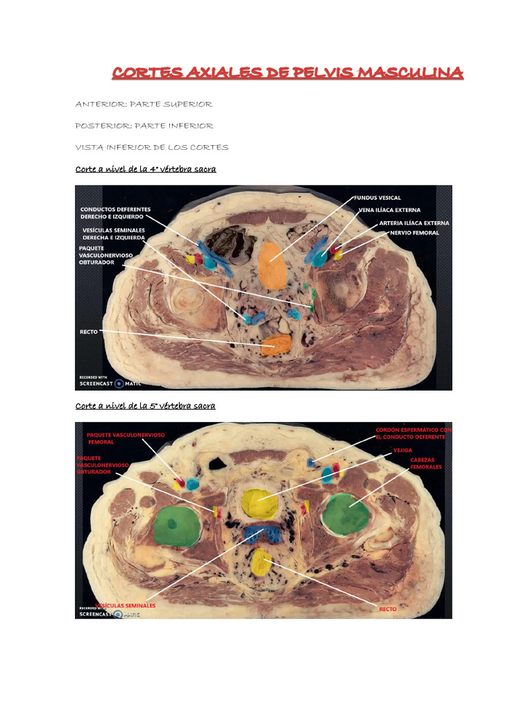 Cortes Axiales de La Pelvis Masculina | PDF