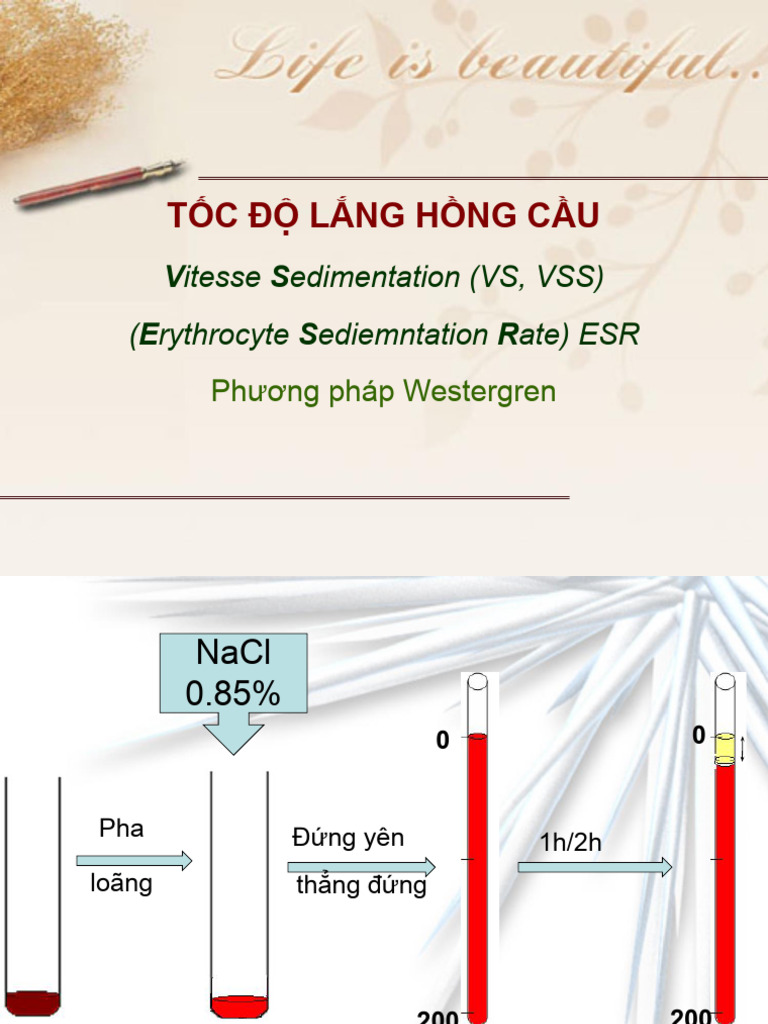 Toc Do Lang Hong Cau 2022 | PDF