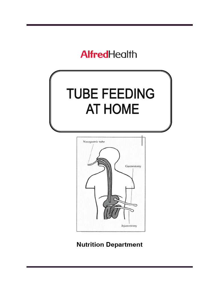 Tube Feeding at Home | Download Free PDF | Digestive System | Clinical ...