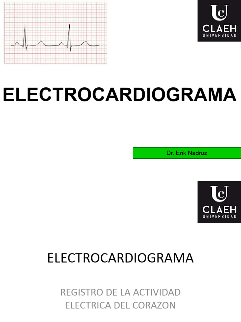 ECG 2024 | PDF