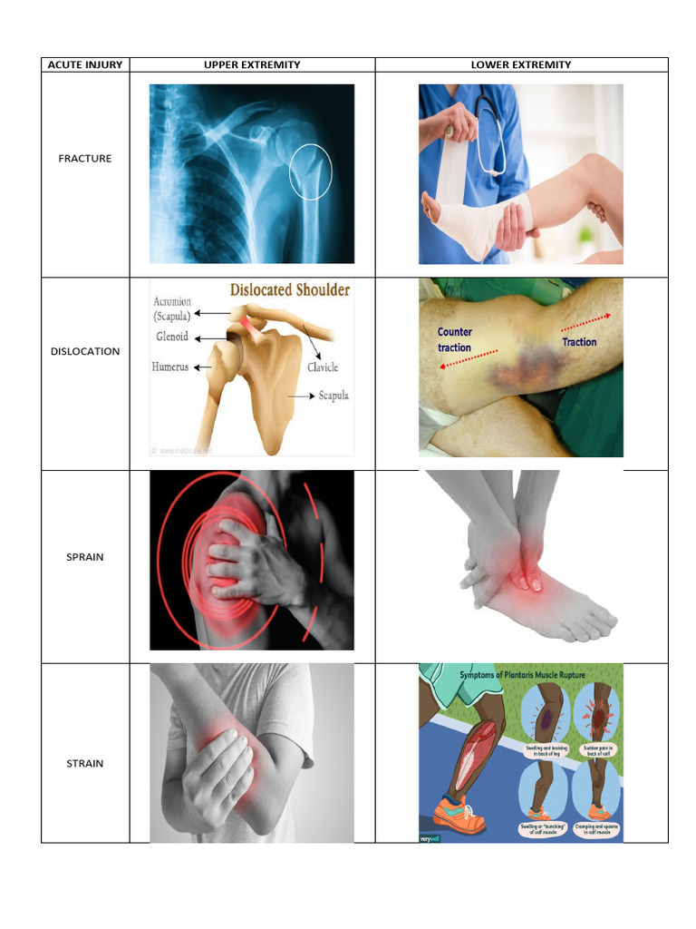 Types of Sports Injuries Explained | PDF