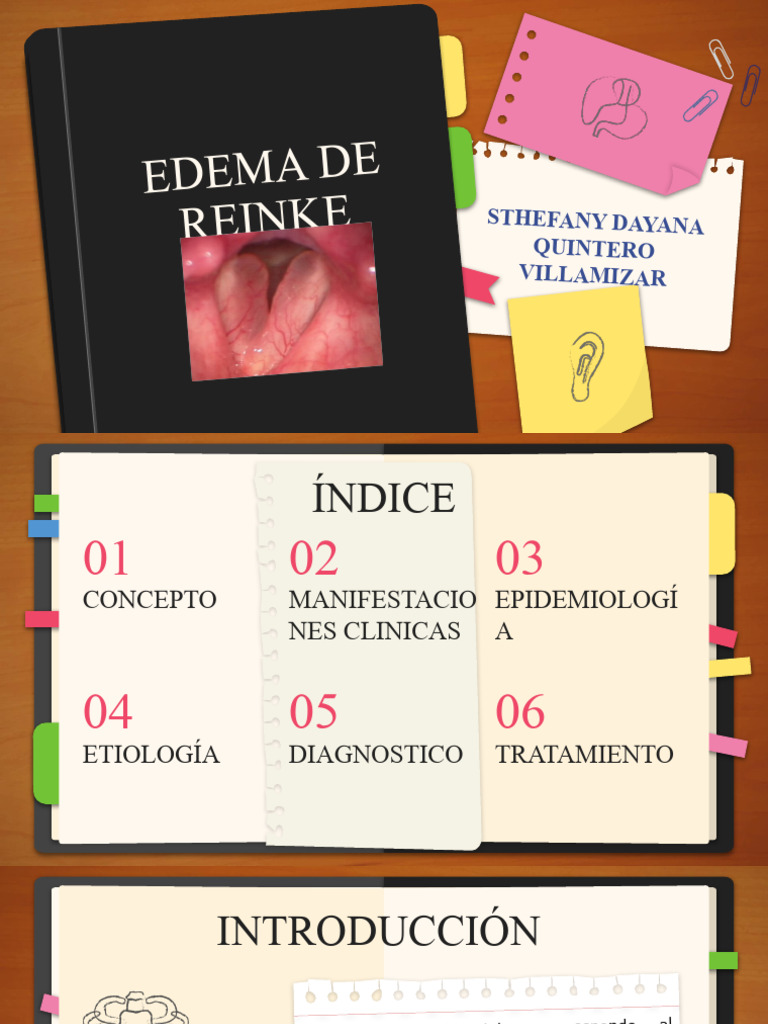 Edema de Reinke | PDF | Edema | Medicina