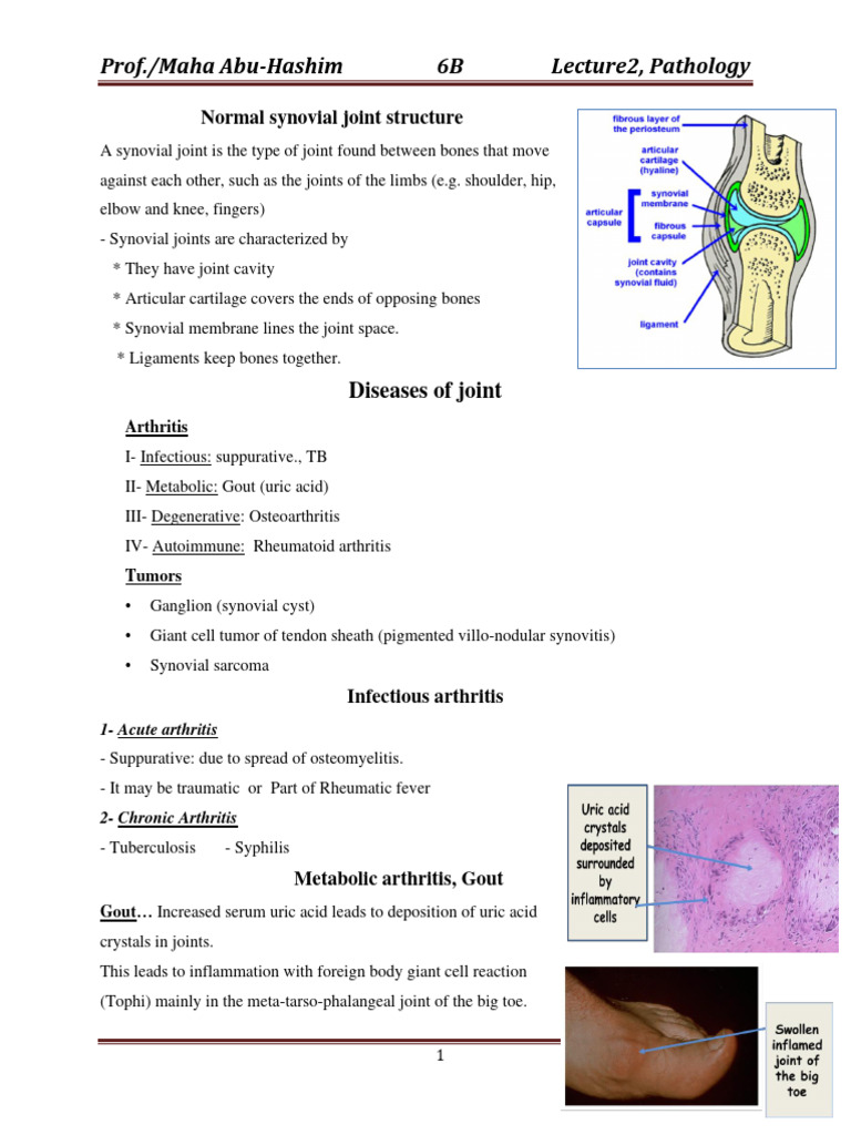 L 2 Pathology, Joints Diseases Lecture Notes | PDF | Joint | Arthritis