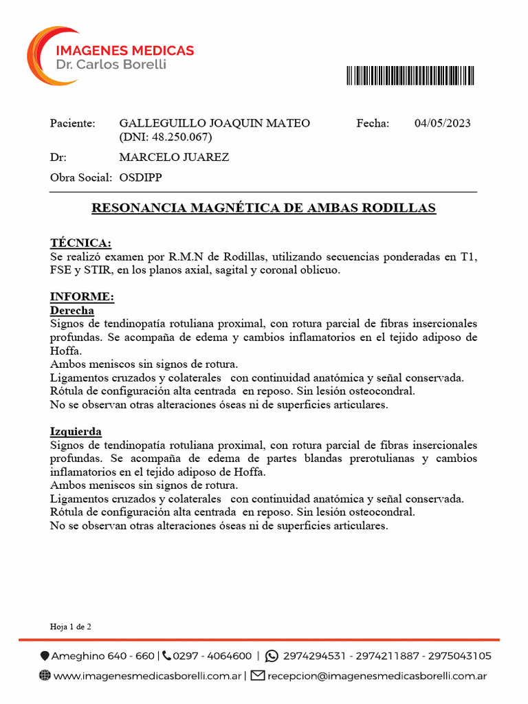 Resonancia Magnética Rodillas: Informe | PDF | Rodilla | Articulaciones