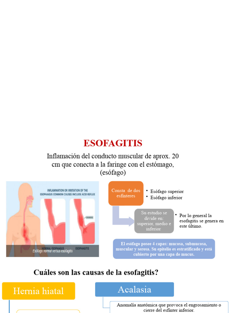 ESOFAGITIS | PDF | La enfermedad por reflujo gastroesofágico | Alergia