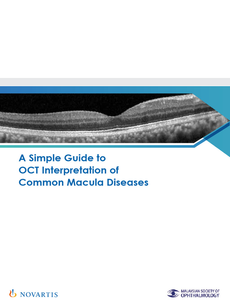 Optical Coherence Tomography (OCT) Handbook | PDF | Visual System ...