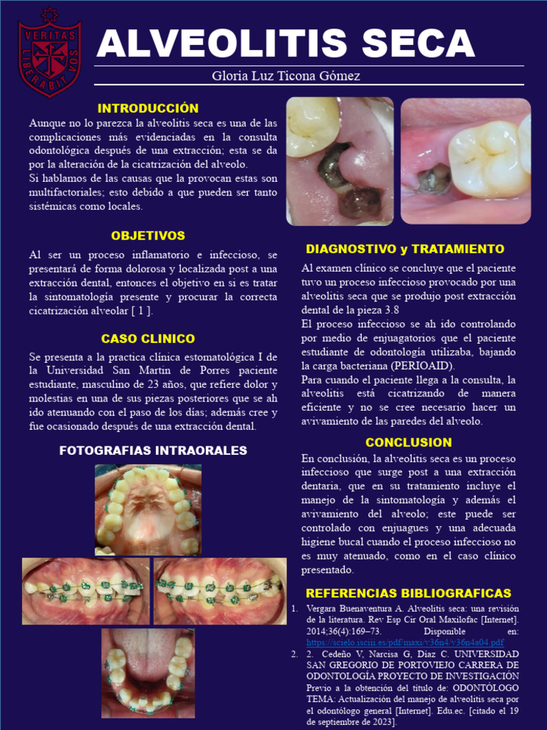 Alveolitis Seca | PDF | Odontología | Causas de la muerte