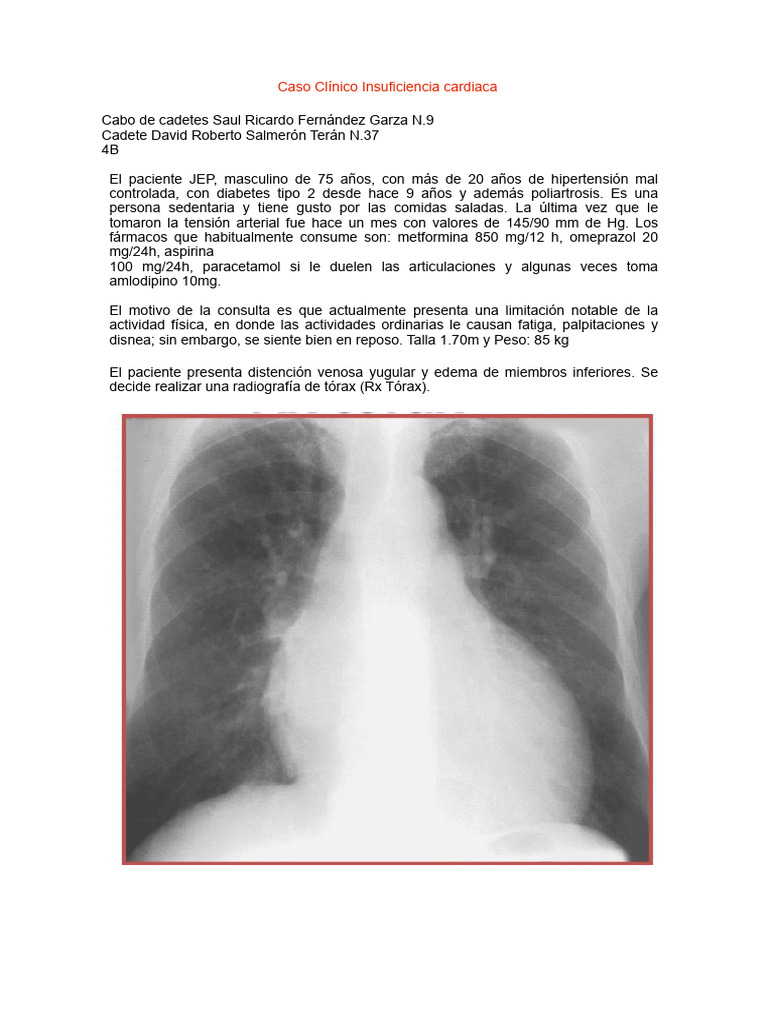 Caso Clínico Insuficiencia Cardíaca | PDF | Insuficiencia cardíaca ... Caso Clínico Insuficiencia Cardíaca | PDF | Insuficiencia cardíaca ...