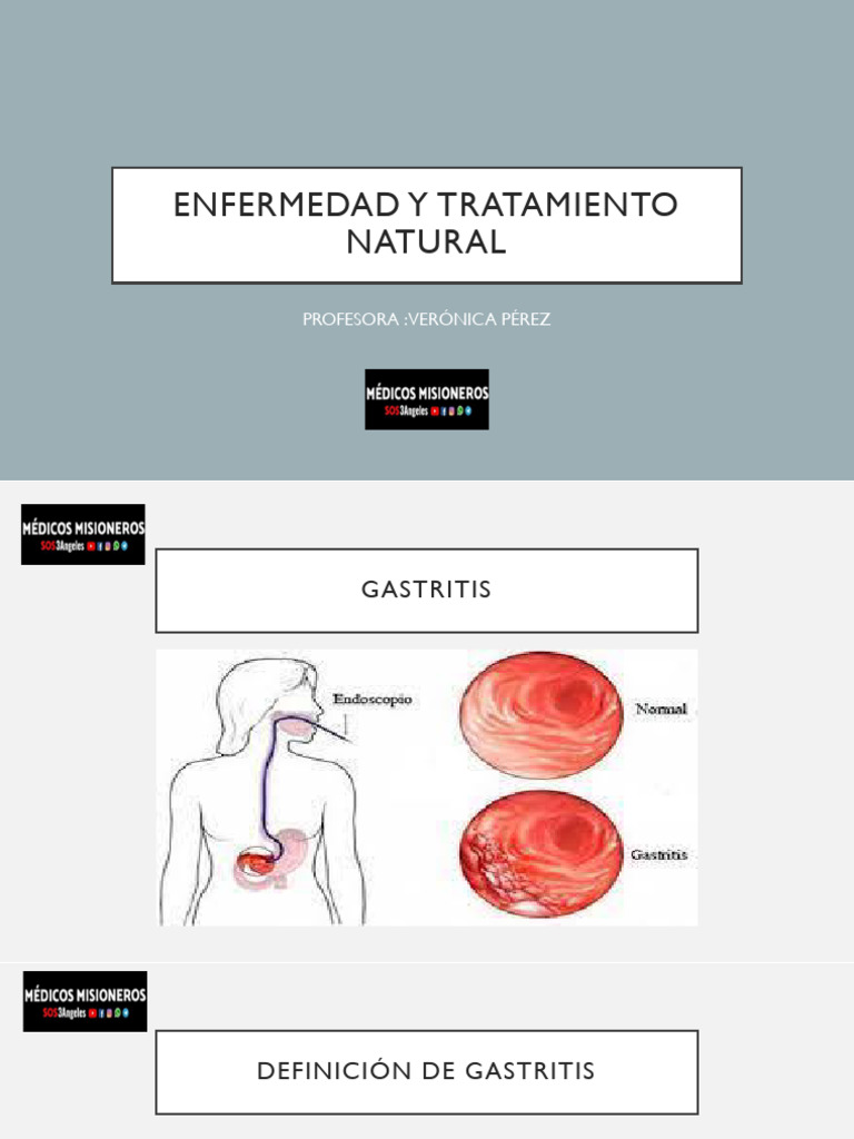 Tratamiento Natural para Gastritis | PDF | Enfermedades y trastornos ...