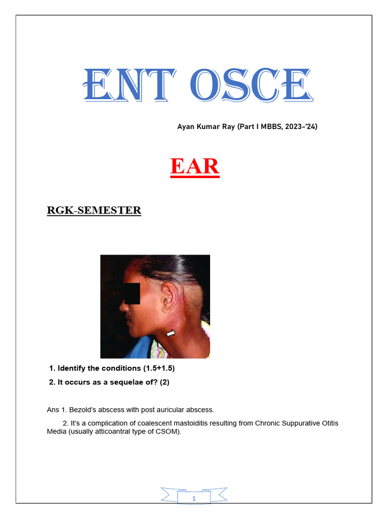 Revised ENT OSCE (MB) | Download Free PDF | Human Nose | Ear