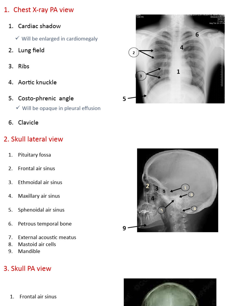 X Rays Head, Neck, Chest | PDF | Vertebra | Human Head And Neck