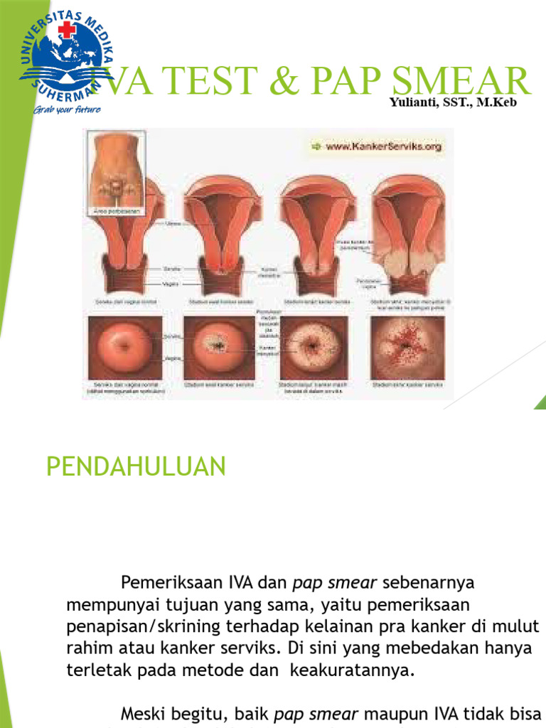 Part+14+Dan+15+ +Skrining+IVA+Test+Dan+Papsmear | PDF