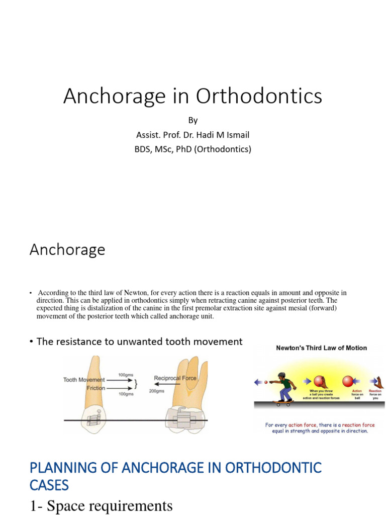 2 Planning Anchorage 1 | PDF | Dental Anatomy | Dentistry Branches