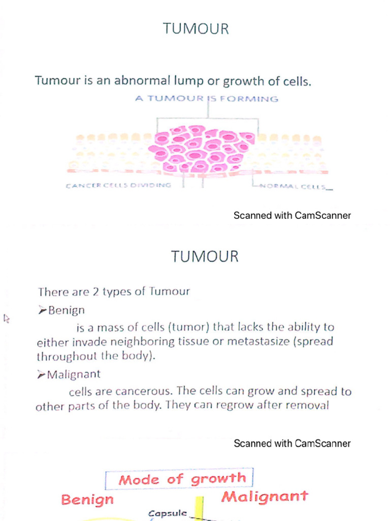 Bone Tumors | PDF