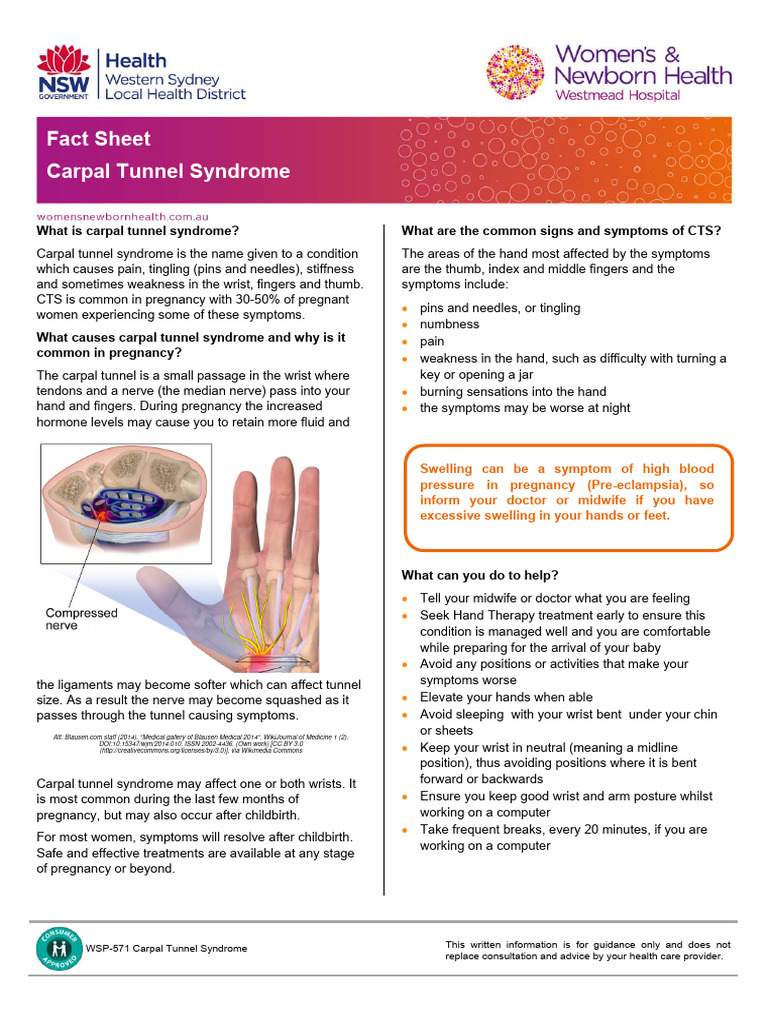 Carpal Tunnel Syndrome V2 FINAL | PDF | Carpal Tunnel Syndrome | Hand