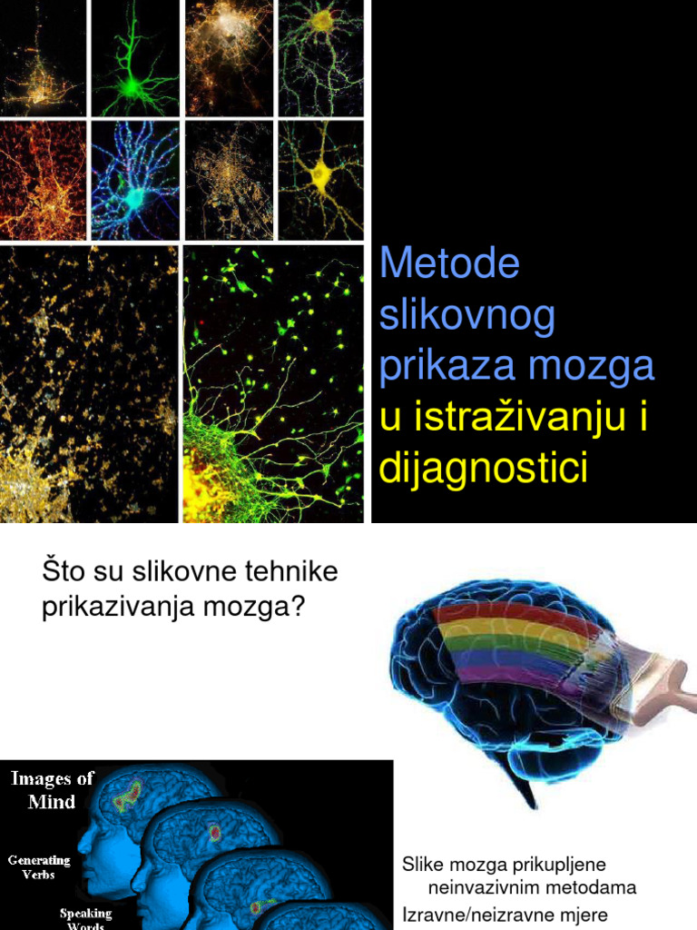 Brain Imaging | PDF