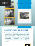 Classificação de Angle: Classes I, II e III | PDF