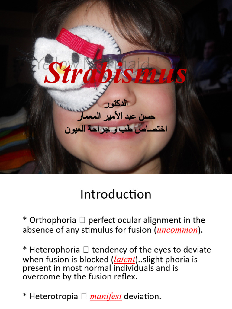 Strabismus 2 | PDF | Eye | Senses