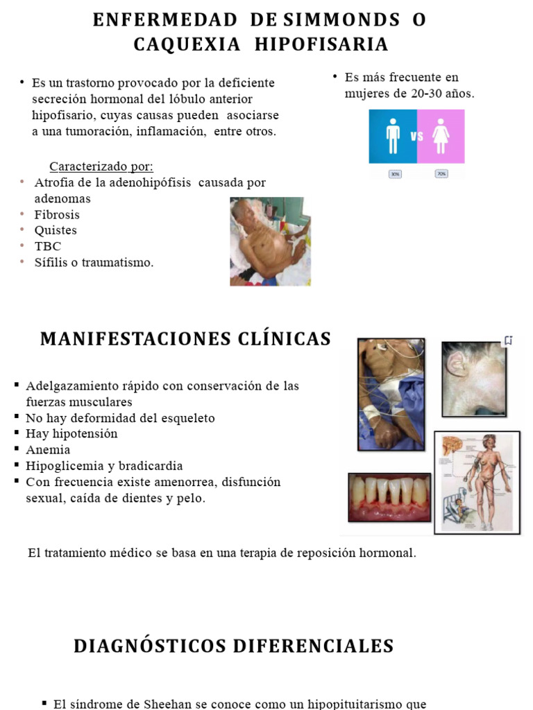 Enfermedad de simmonds | PDF