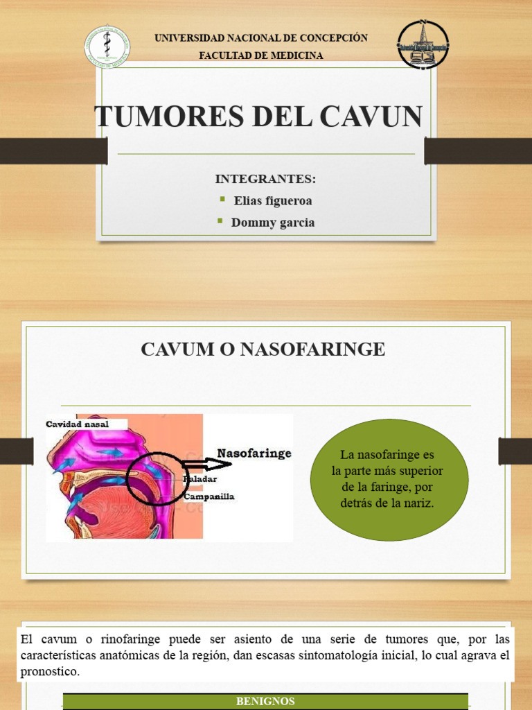 Tumores de Cavum 2024 | PDF | Neoplasias | Cáncer