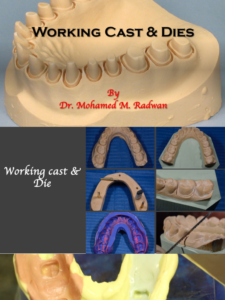 Working Casts and Dies in Dentistry | PDF | Tooth | Mouth