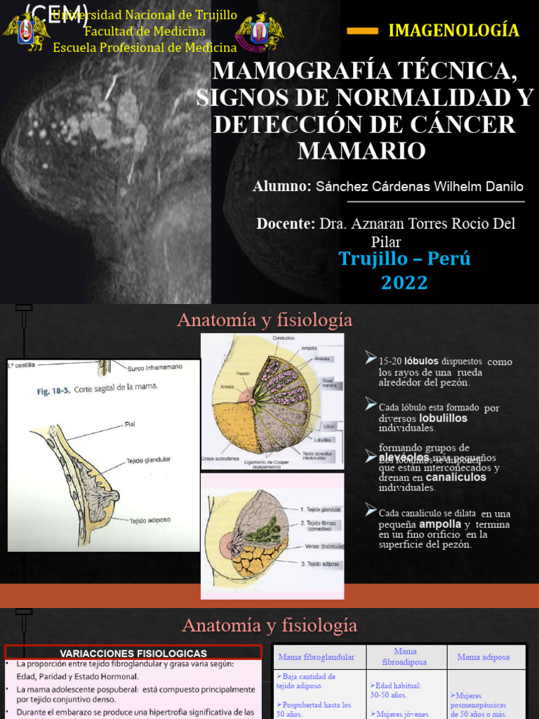 Mamografia Normal | PDF | Mamografía | Cáncer de mama