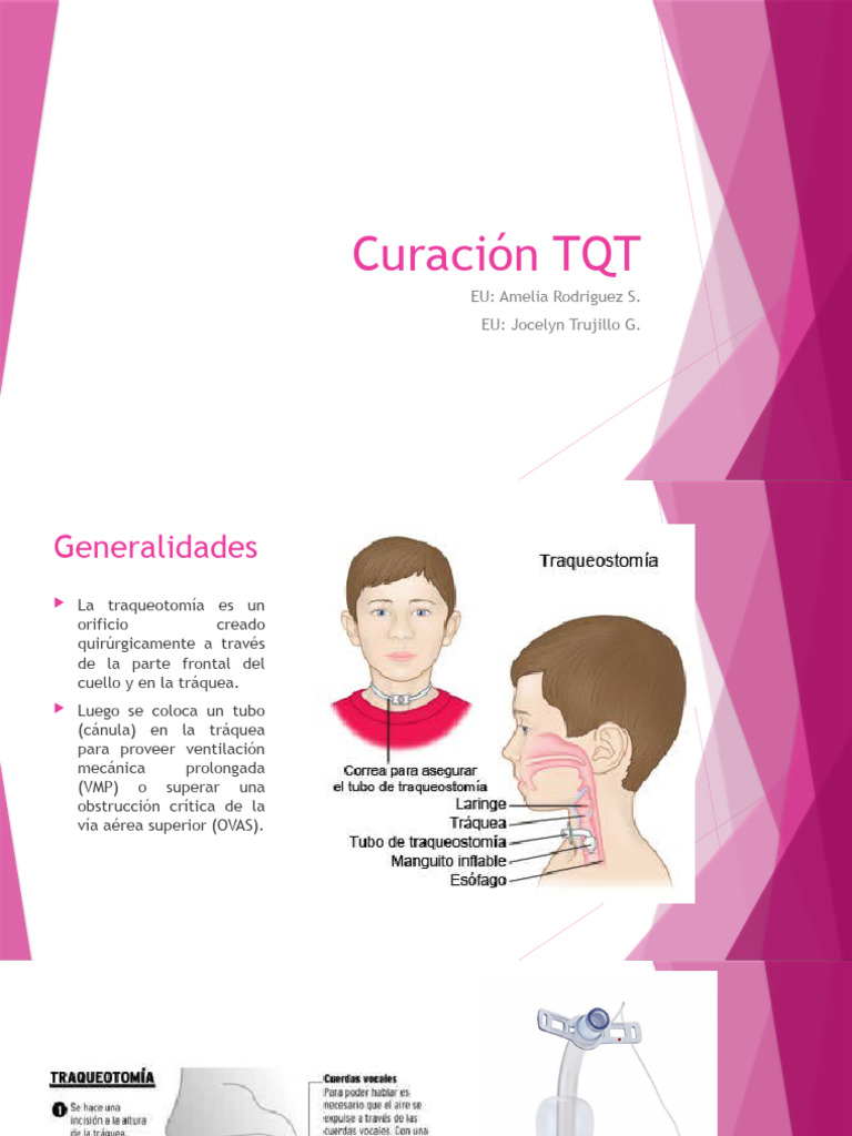 Curación de Traqueotomía: Guía SEO | PDF | Medicina | Enfermedades y ...