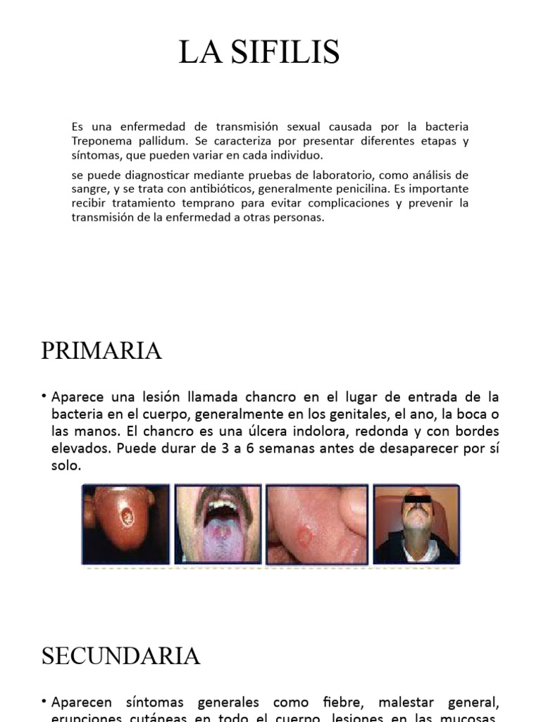 Sífilis: Etapas, síntomas y tratamiento | PDF