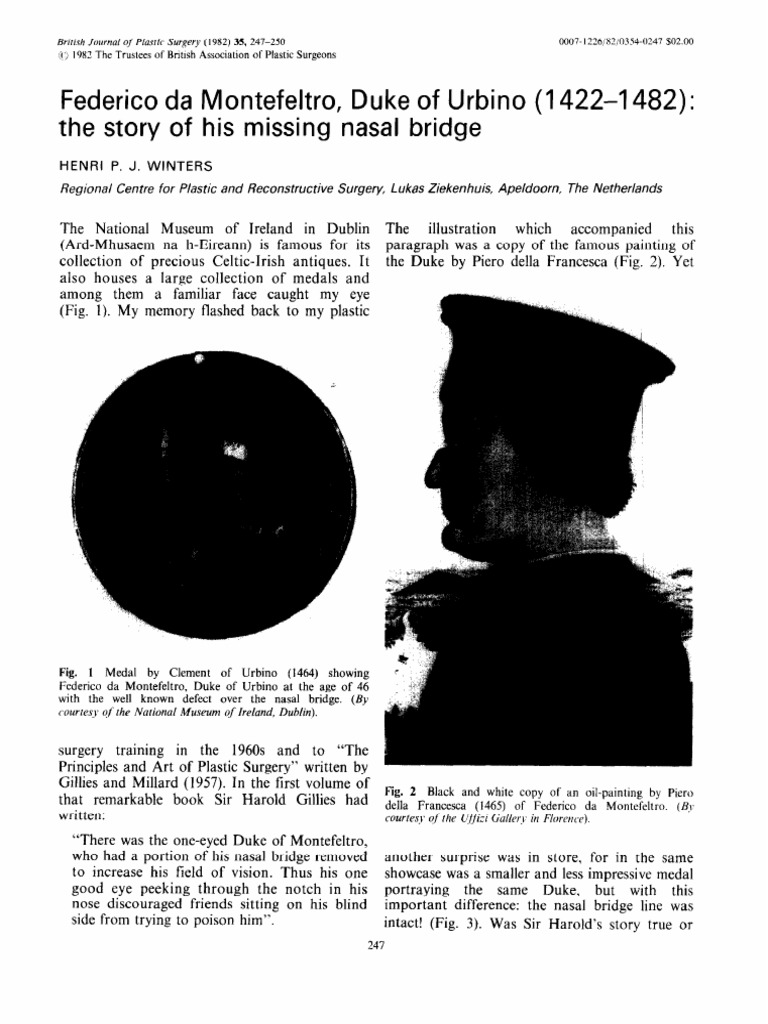 Federico Da Montefeltro, Duke of Urbino: The Story of His Missing Nasal ...