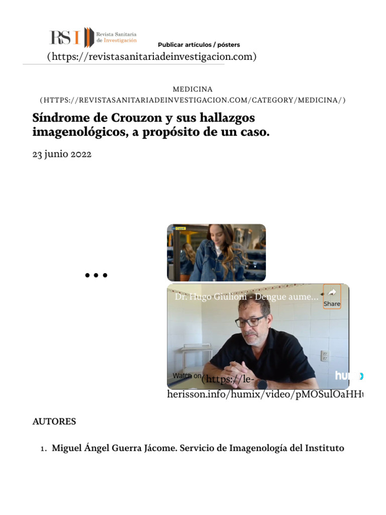 Síndrome de Crouzon y Sus Hallazgos Imagenológicos, A Propósito de Un ...