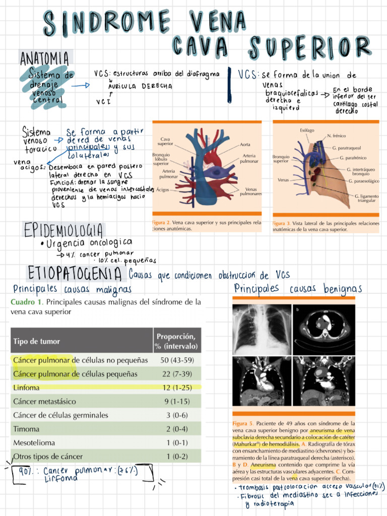 Sx Vena Cava Superior | PDF | Neoplasias | Cáncer