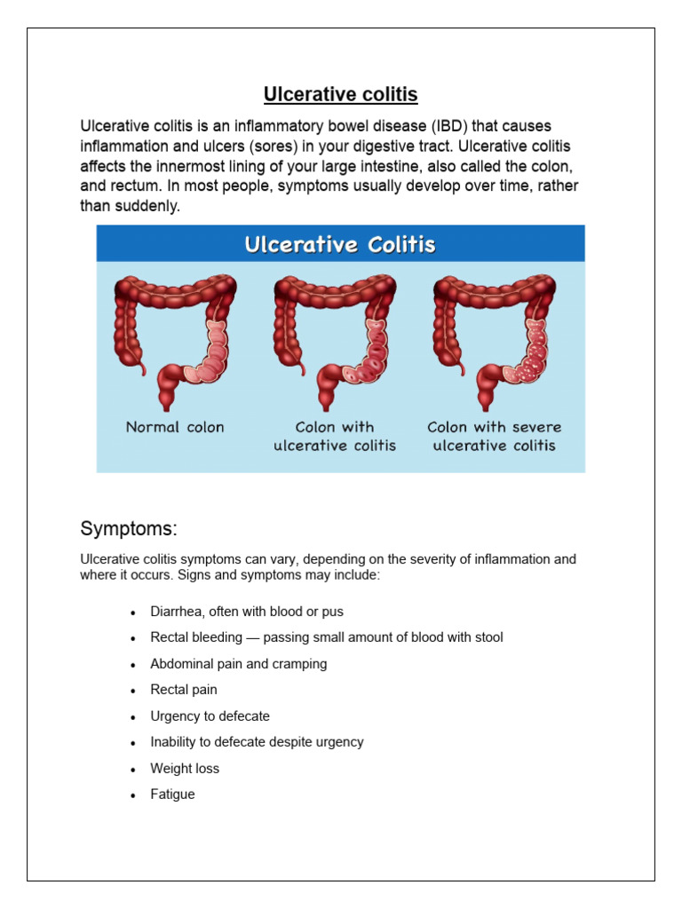 Ulcerative colitis | PDF | Ulcerative Colitis | Causes Of Death