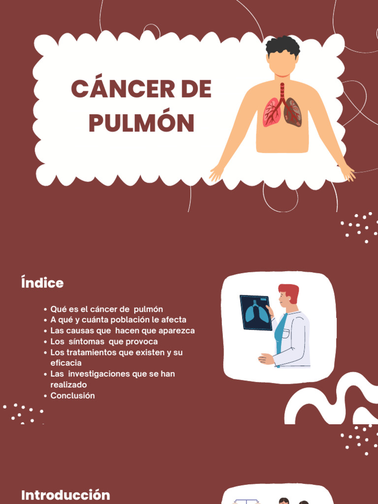 Cancer de Pulmón | PDF