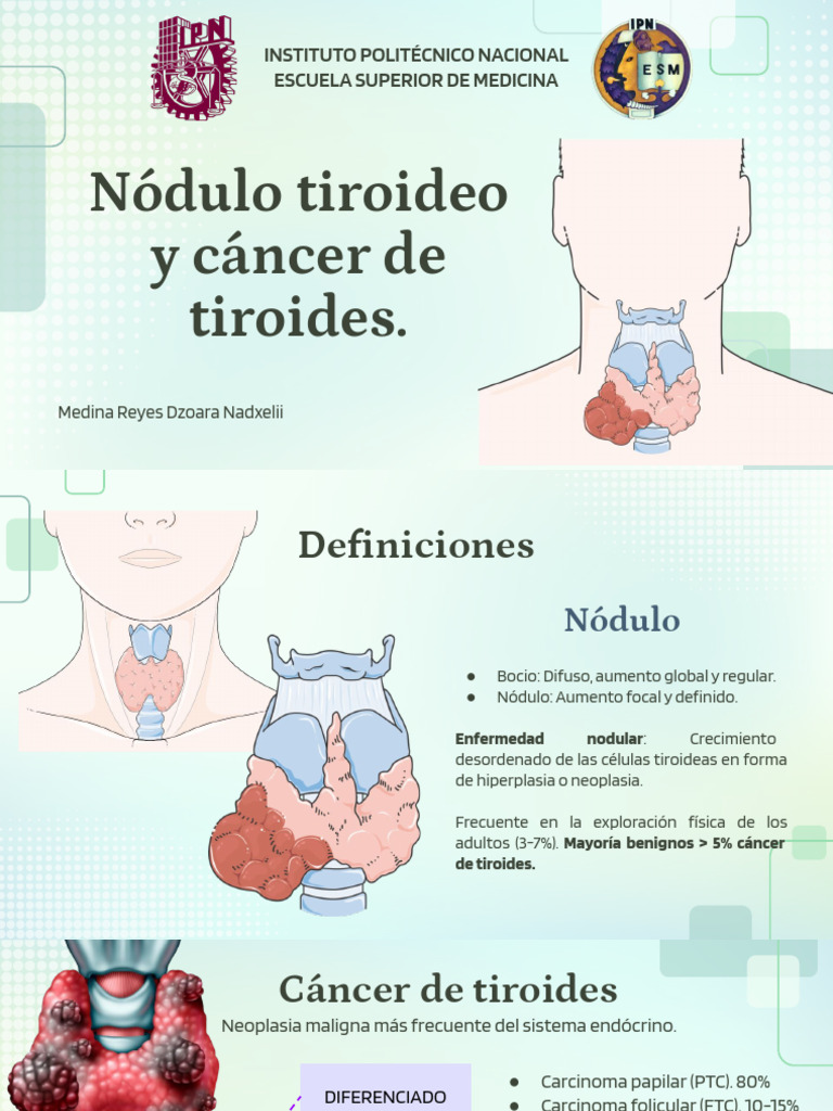 Nódulo Tiroideo y Cáncer de Tiroides | PDF | Bioquímica | Química