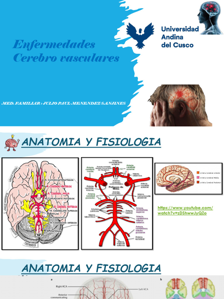 Accidente Cerebro Vascular Isquemico y Hemorragico | PDF | Carrera | Isquemia