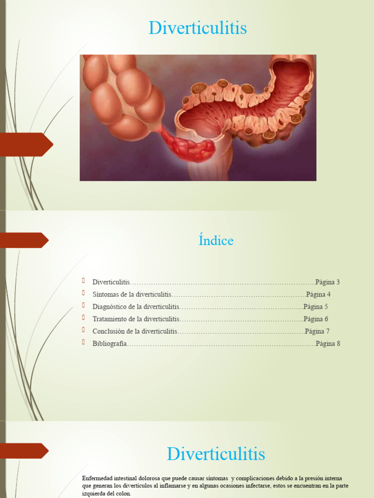 Diverticulitis | PDF