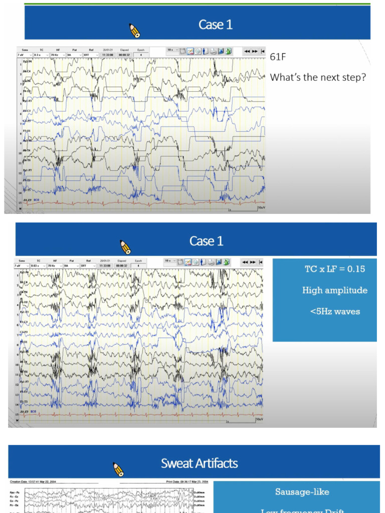 Case EEG | PDF