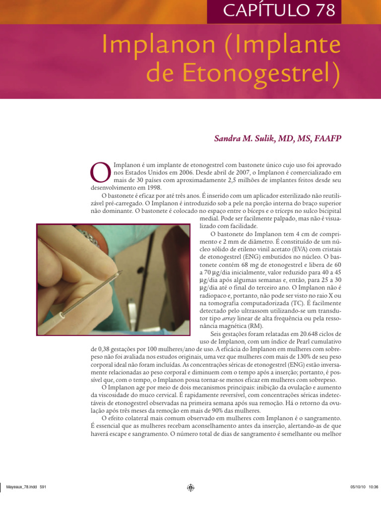 Implanon Guia Como | PDF | Anticoncepcionais | Ciclo menstrual