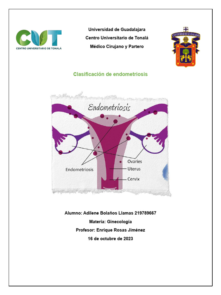 Clasificacion de la endometriosis | PDF