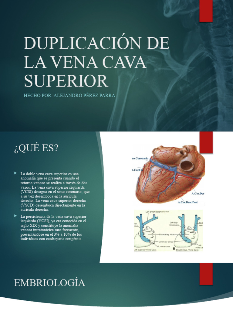 Duplicación de la Vena Cava Superior | PDF | Viajes y turismo