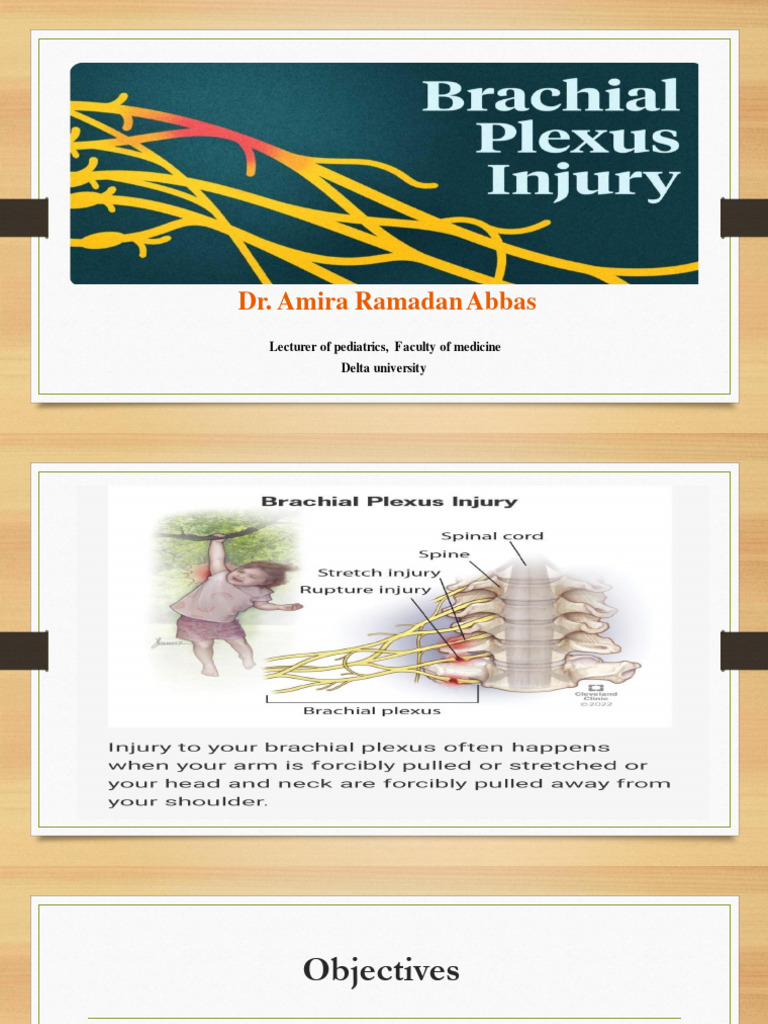 Brachial Plexus Injury PDF | PDF | Human Anatomy | Anatomy