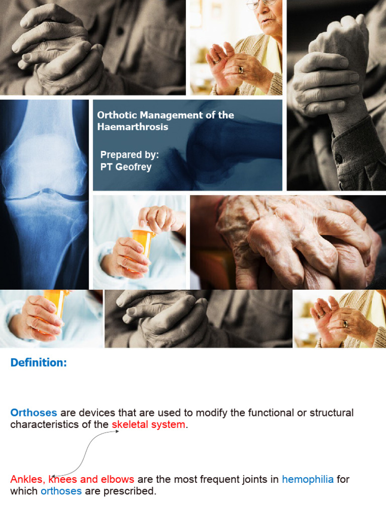 Orthotic Management of The Haemarthrosis | PDF | Musculoskeletal System ...