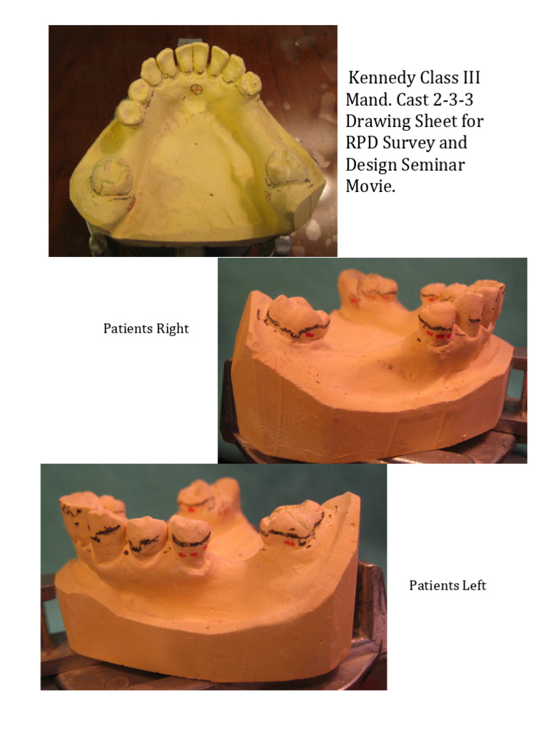 Ken Class III Mand Cast Drawing Page For Part D 2-3-3 SM | PDF