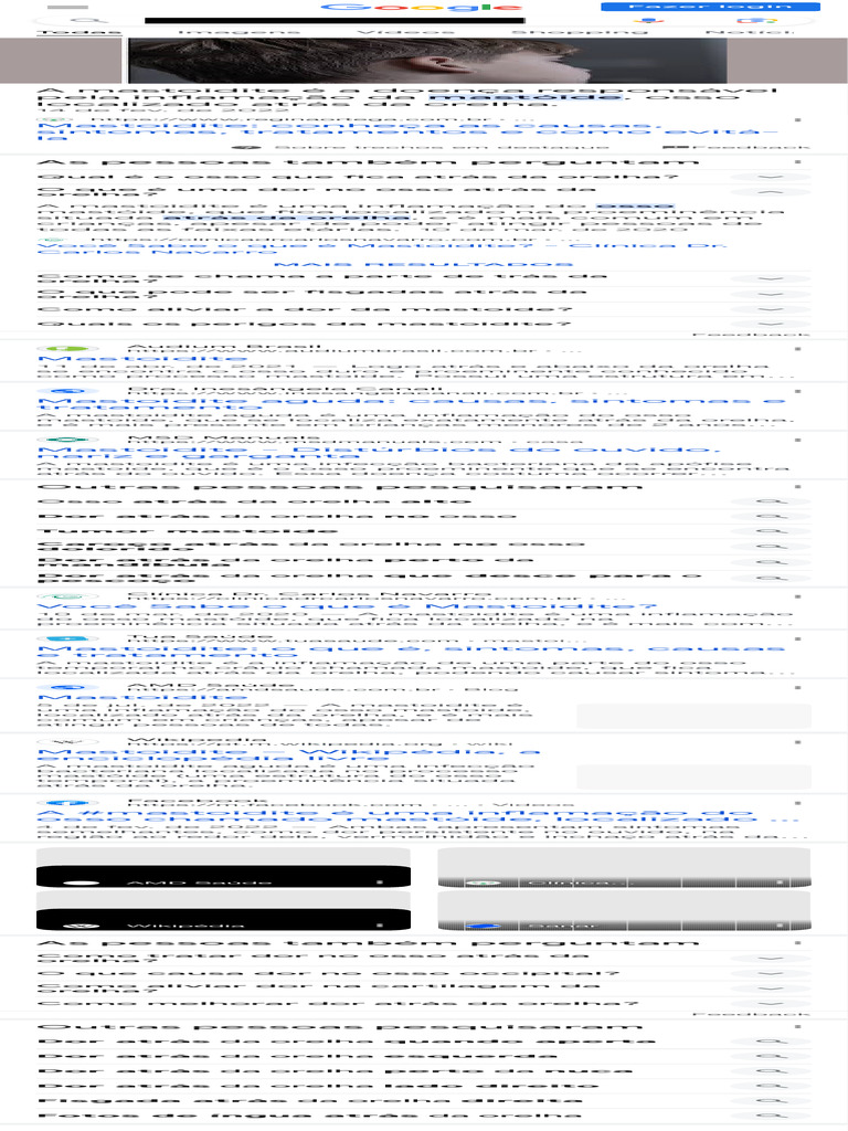 Como e Chamado o Osso Atras Da Orelha - Pesquisa Google | Download grátis PDF | Medicina Clínica ...