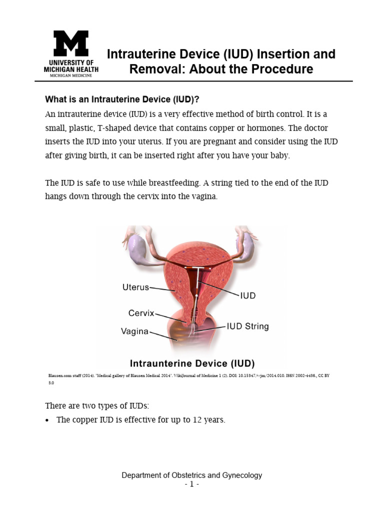 Iud Insertion Removal in Clinic | PDF | Gynaecology | Human Reproduction